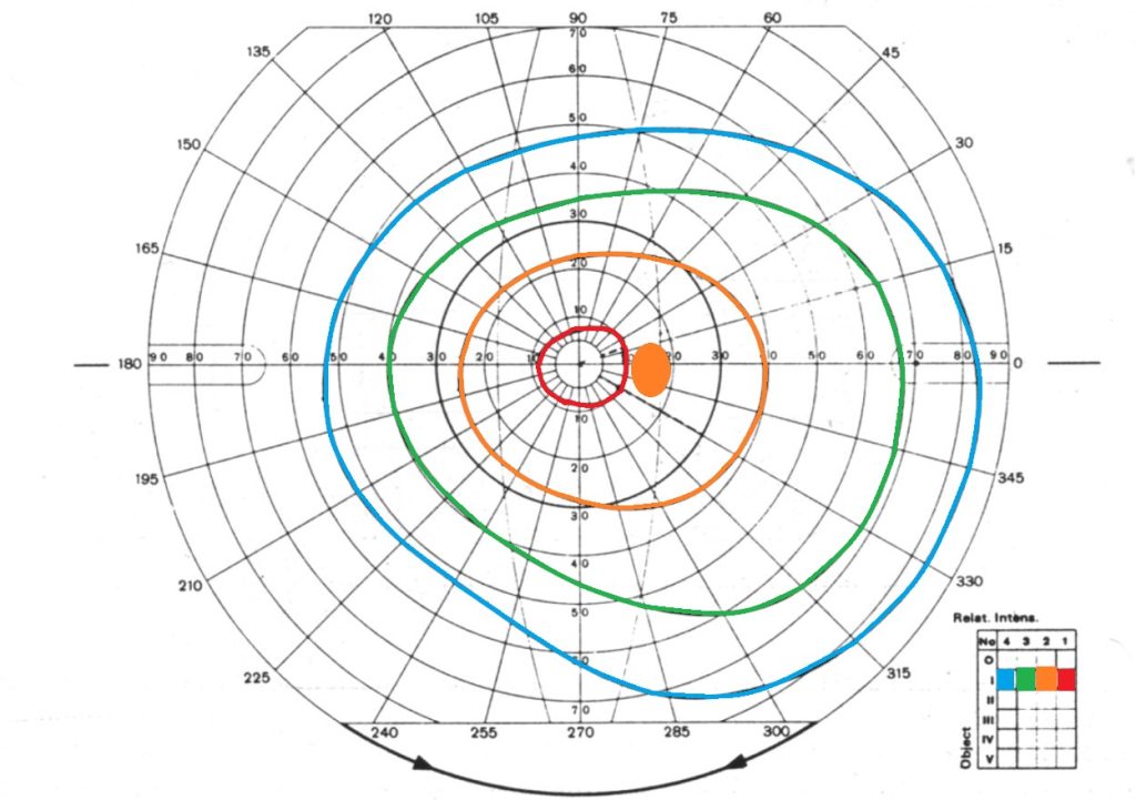 検診に使うため、ゴールドマン視野計を探しています | 自由が丘 清澤眼科