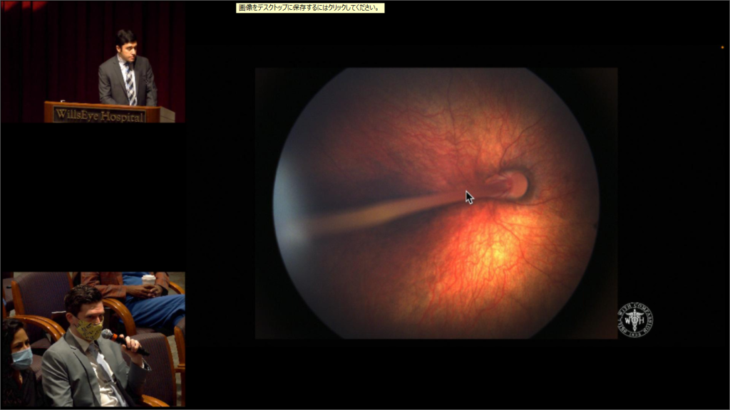 FEVR（家族性滲出性硝子体網膜症）: 本日のウイルズ眼科病院網膜カウンセリングから | 自由が丘 清澤眼科