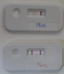 流行性角結膜炎（EKC, epidemic keratoconjunctivitis）とは | 自由が丘 清澤眼科