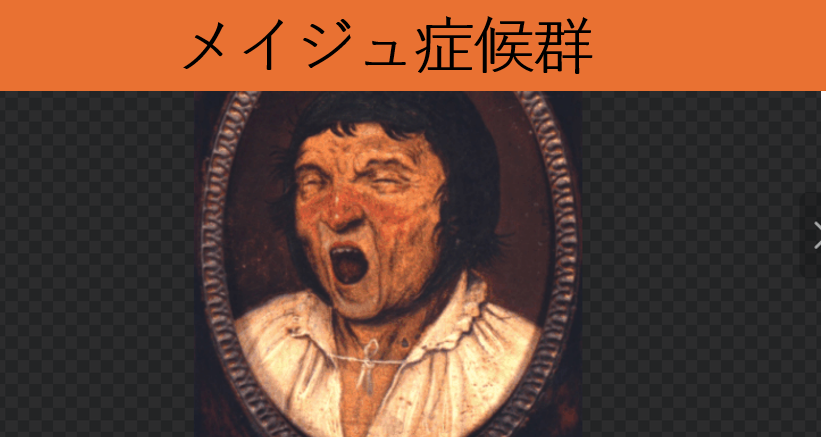 メイジュ（Meige）症候群を説明しましょう | 自由が丘 清澤眼科