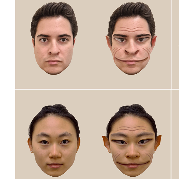 不思議の国のアリス症候群？悪魔の顔症候群？ | 自由が丘 清澤眼科