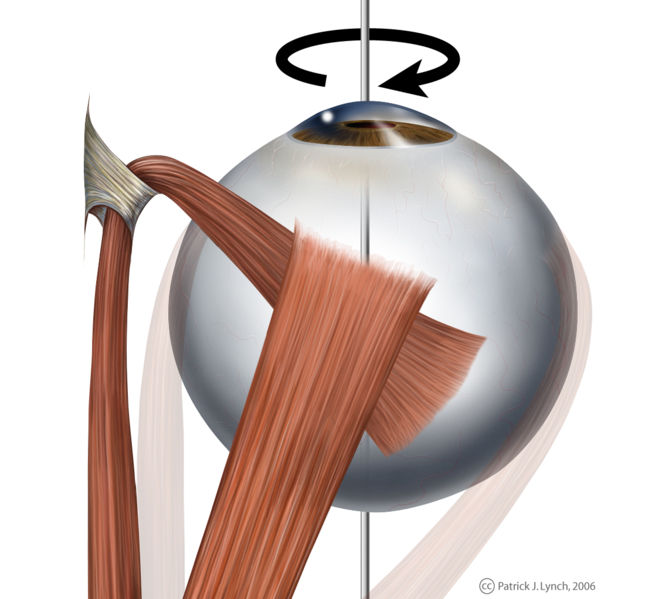 上斜筋ミオキミア（superior oblique myokimia）に対するオフラベル治療としてのβ遮断薬点眼 | 自由が丘 清澤眼科